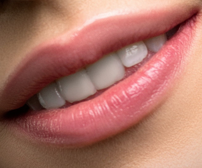 Lippenaufbau: Natürliche Lippenkontur – Dr. med. Christiane Handrick